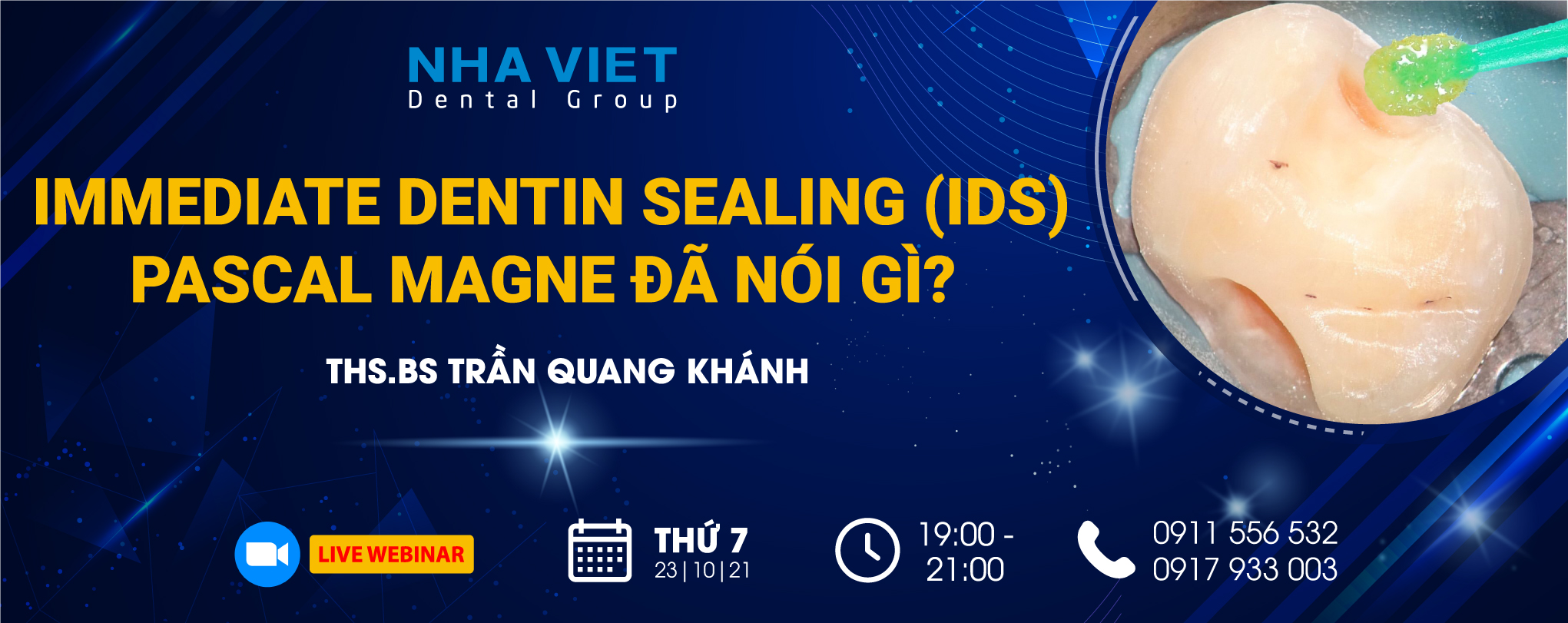 CHƯƠNG TRÌNH HỘI THẢO TRỰC TUYẾN “IMMEDIATE DENTIN SEALING (IDS ...